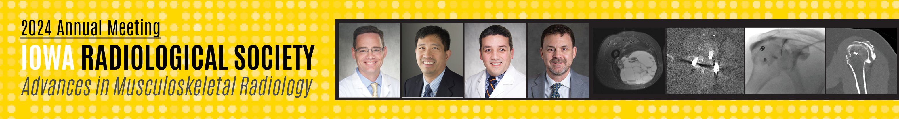 Iowa Radiological Society 2024 Annual Meeting: Advances in ...
